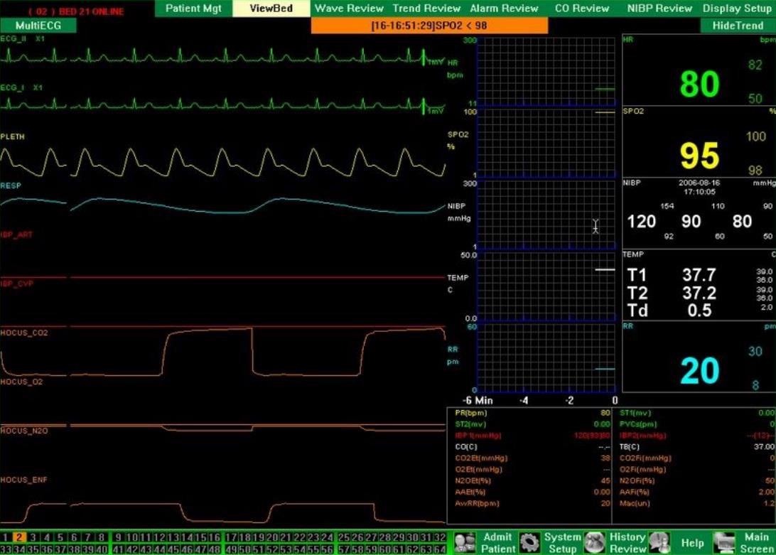 The Central Station Software enables real-time monitoring of vital ...