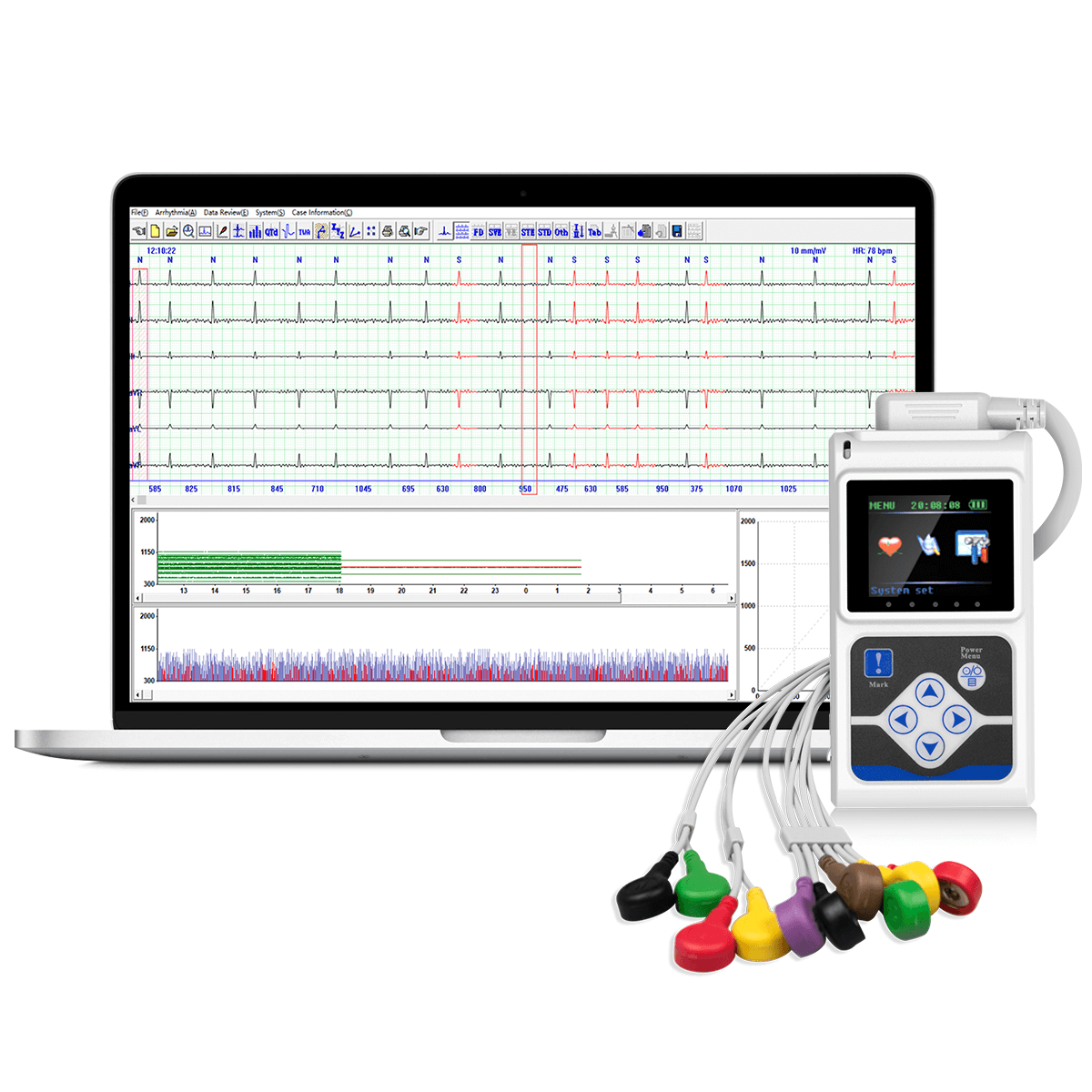 Portable 12-Lead ECG Machine for Professional Usage. 3-Channel EKG ...
