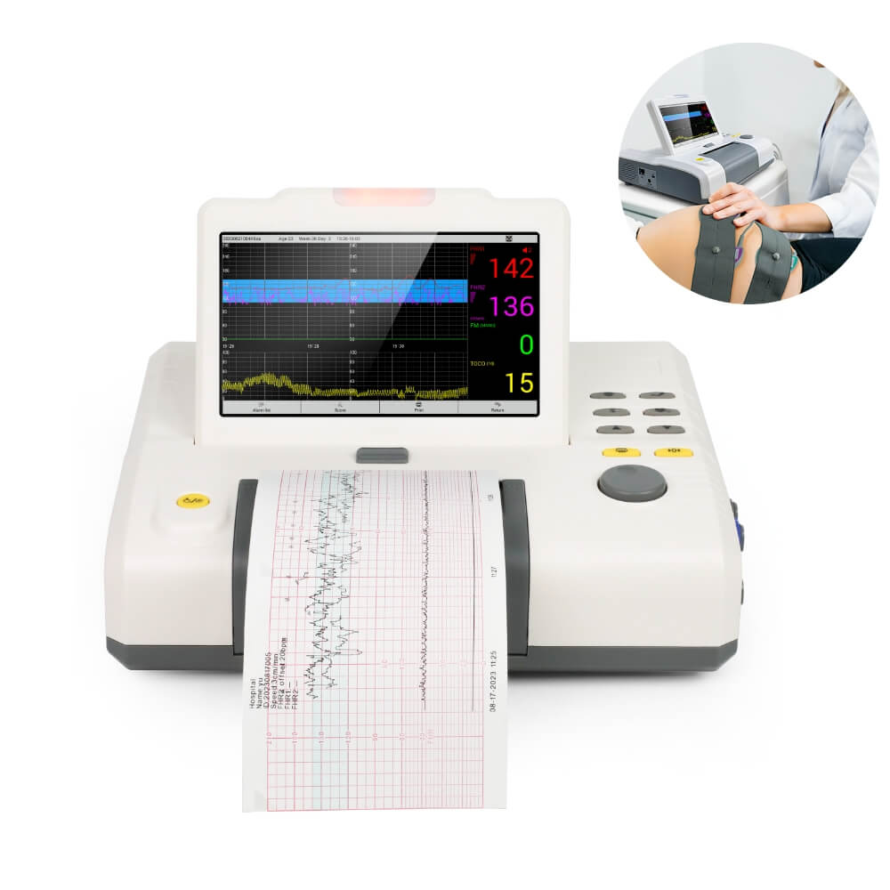 24-Hour ECG Monitor with AI Analysis, Continuous ECG/EKG Monitoring at ...