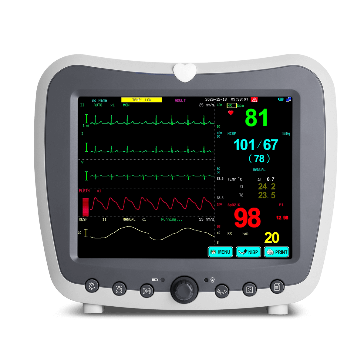 8-Inch Touchscreen+EtCO2 Portable Patient Monitor- Tracks Vital ...