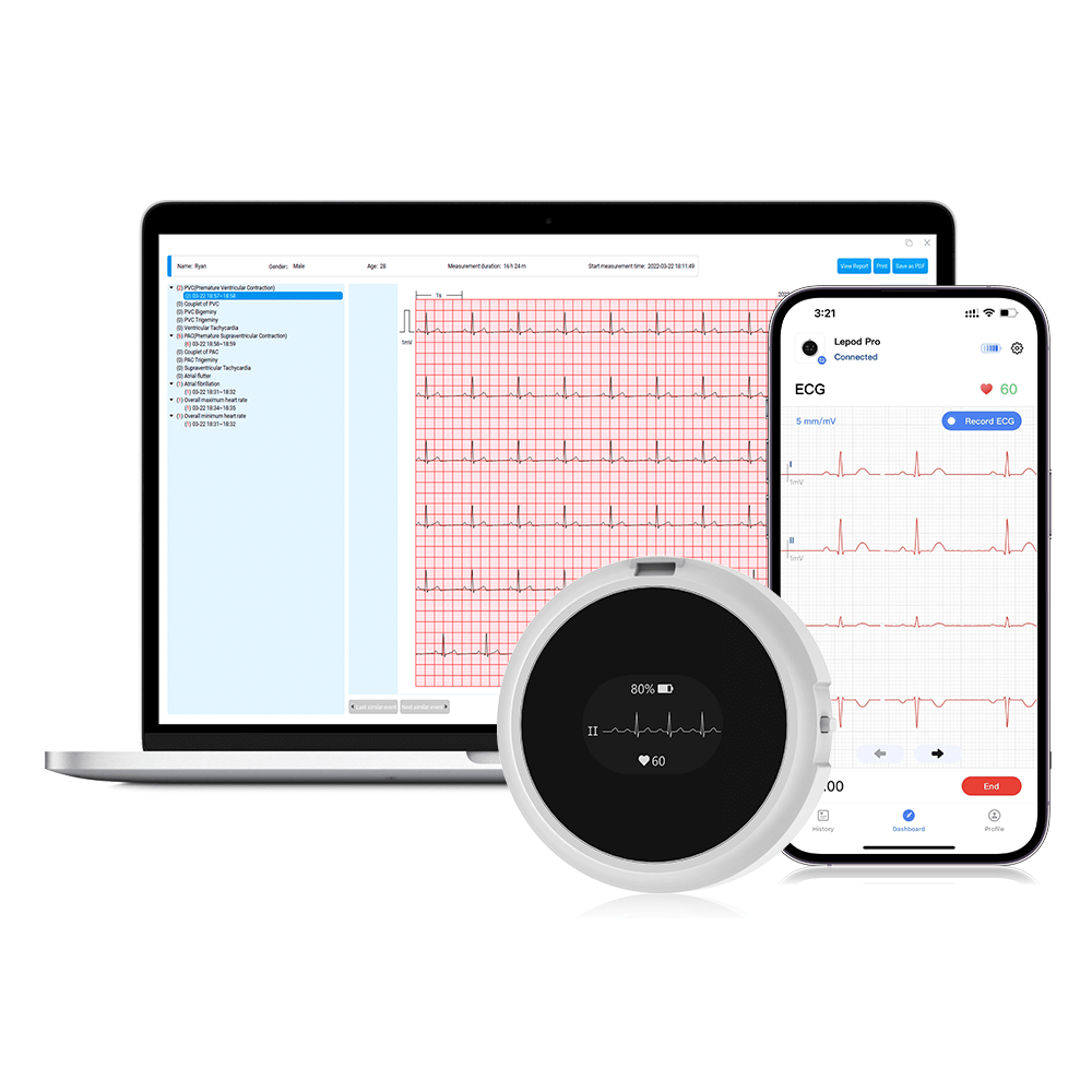 Wellue 12-Lead Holter Monitor- Get AI-analyzed ECG reports on PC & App