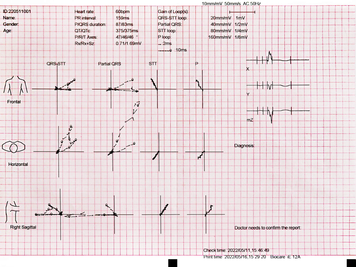 Biocare iE12A 12-Channel ECG Machine Paper Refill – Wellue